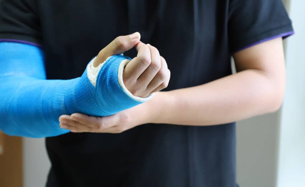 Hand Fracture? Here’s What to Do Next - Spire Ortho